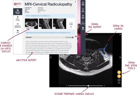 SKG Patient Portal - Application and UX | Mettro